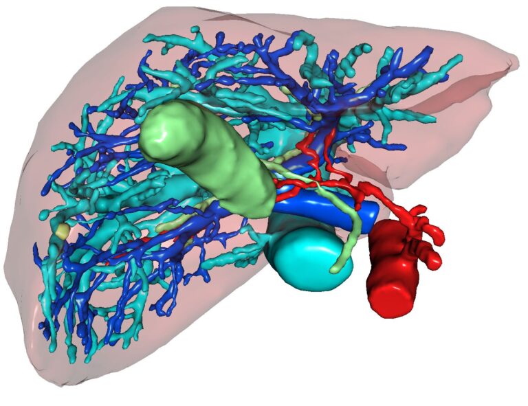 Liver - Visible Patient