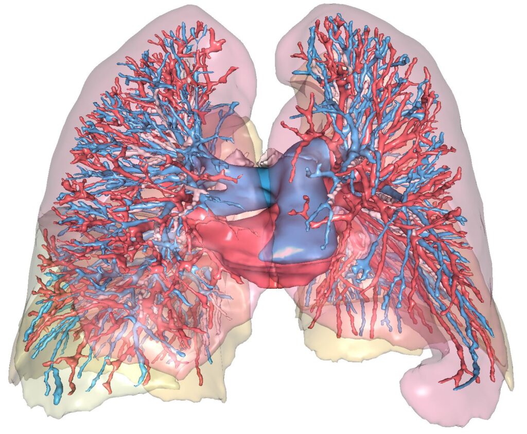 Les poumons - Visible Patient