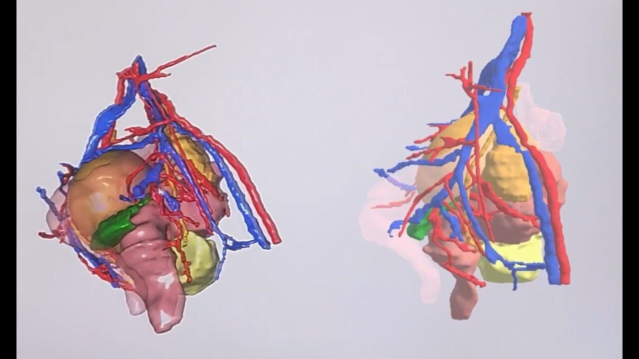 Nos actualités - Visible Patient